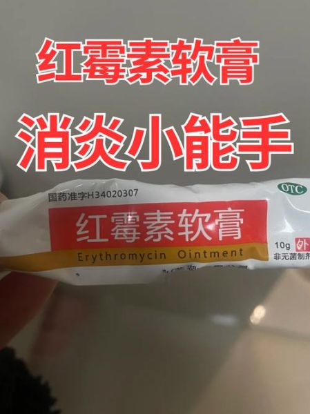 红霉素软膏治痘痘有用吗_红霉素软膏治痘痘多久见效-第1张图片-山城妙识