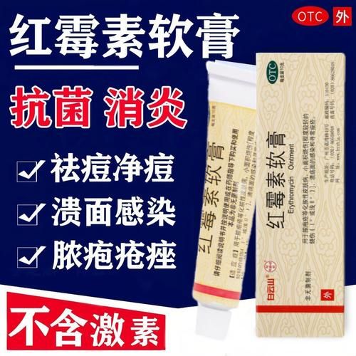 红霉素软膏治痘痘有用吗_红霉素软膏治痘痘多久见效-第2张图片-山城妙识