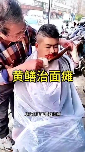 黄鳝血治疗面瘫的用法_面瘫用黄鳝血真的有用吗-第1张图片-山城妙识 黄鳝血治疗面瘫的用法_面瘫用黄鳝血真的有用吗-第1张图片-山城妙识