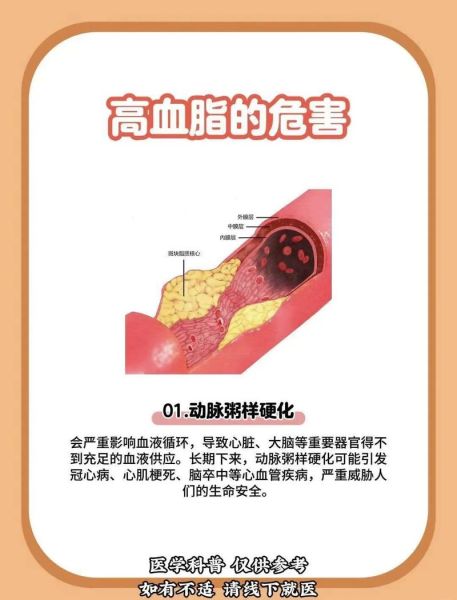 血脂高有什么危害_高血脂的危害有哪些-第1张图片-山城妙识 血脂高有什么危害_高血脂的危害有哪些-第1张图片-山城妙识