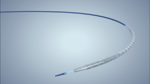 巧克力球囊是什么_巧克力球囊多少钱-第1张图片-山城妙识 巧克力球囊是什么_巧克力球囊多少钱-第1张图片-山城妙识