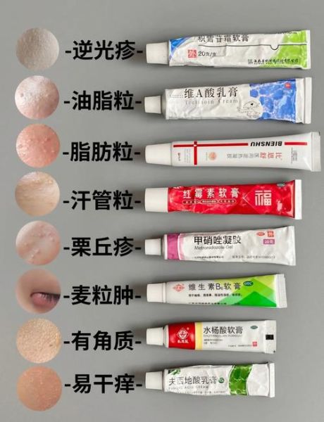 脂肪粒怎么去除_脂肪粒和粉刺的区别-第1张图片-山城妙识 脂肪粒怎么去除_脂肪粒和粉刺的区别-第1张图片-山城妙识