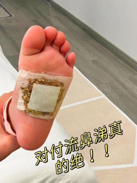 受凉流清鼻涕怎么办_最快缓解方法-第2张图片-山城妙识