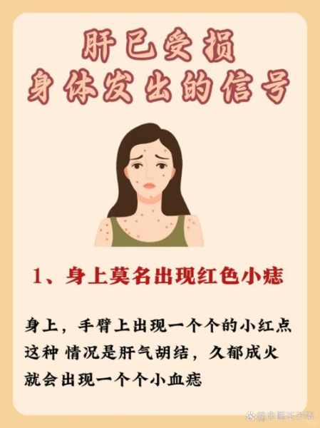 肝脏不好的症状有哪些_肝病早期信号-第1张图片-山城妙识 肝脏不好的症状有哪些_肝病早期信号-第1张图片-山城妙识