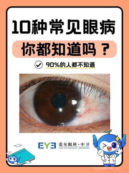 红鱼眼是什么_红鱼眼怎么治-第3张图片-山城妙识 红鱼眼是什么_红鱼眼怎么治-第3张图片-山城妙识