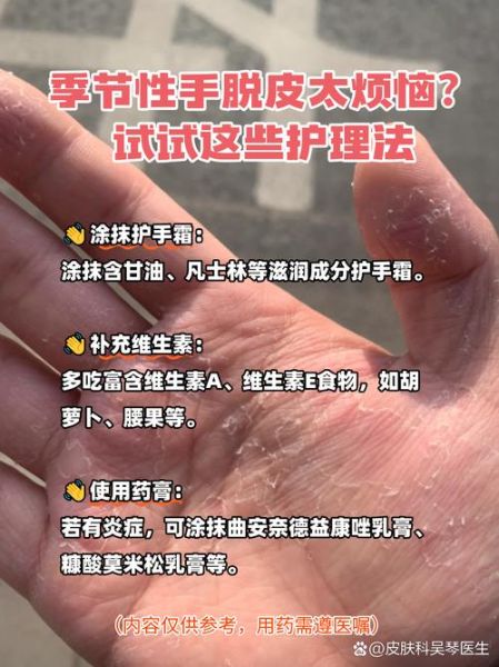 长期手浮多久可以恢复_怎么治疗-第2张图片-山城妙识 长期手浮多久可以恢复_怎么治疗-第2张图片-山城妙识