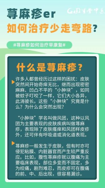 荨麻疹会传染吗_荨麻疹是怎么引起的-第1张图片-山城妙识