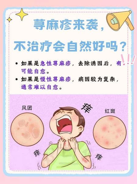 荨麻疹怎么快速自愈_荨麻疹自愈方法有哪些-第3张图片-山城妙识