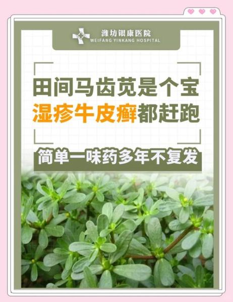 马齿苋治疗皮肤病有效吗_马齿苋怎么用治湿疹-第2张图片-山城妙识