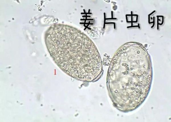 姜片虫如何杀死_姜片虫用什么药最快-第2张图片-山城妙识 姜片虫如何杀死_姜片虫用什么药最快-第2张图片-山城妙识