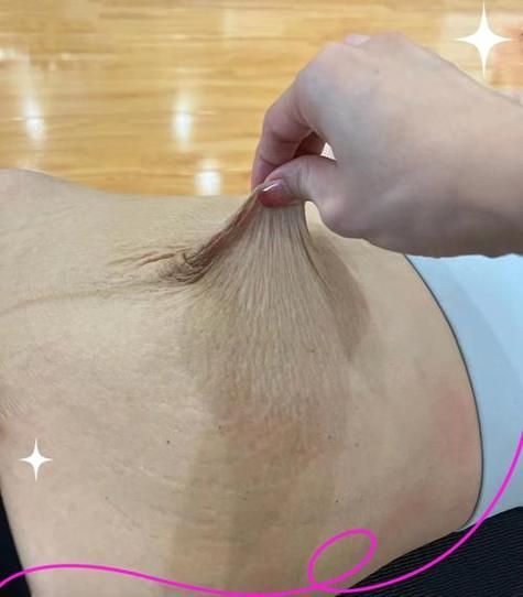 肉皮松弛怎么变紧致_皮肤松弛下垂怎么办-第1张图片-山城妙识 肉皮松弛怎么变紧致_皮肤松弛下垂怎么办-第1张图片-山城妙识