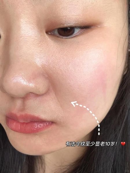 肉皮松弛怎么变紧致_皮肤松弛下垂怎么办-第3张图片-山城妙识 肉皮松弛怎么变紧致_皮肤松弛下垂怎么办-第3张图片-山城妙识