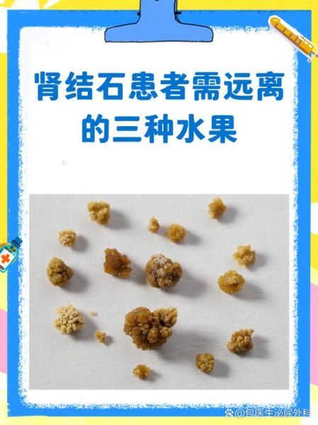 吃什么水果补肾_肾不好能吃哪些水果-第3张图片-山城妙识