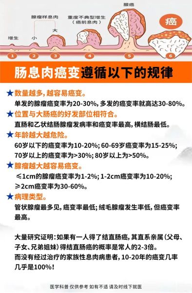 直肠息肉会癌变吗_直肠息肉切除后多久恢复-第3张图片-山城妙识 直肠息肉会癌变吗_直肠息肉切除后多久恢复-第3张图片-山城妙识