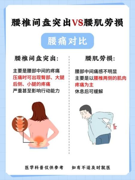 腰肌劳损疼痛位置图_如何缓解-第3张图片-山城妙识 腰肌劳损疼痛位置图_如何缓解-第3张图片-山城妙识