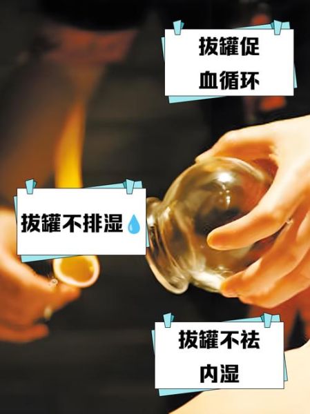拔火罐能去湿气吗_湿气重拔火罐有效吗-第2张图片-山城妙识