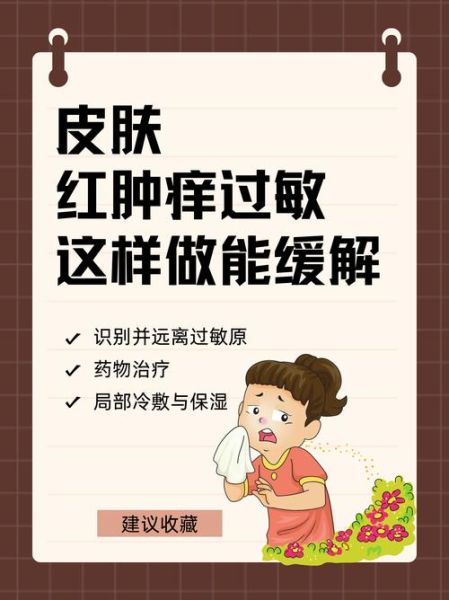 过敏症状有哪些表现_过敏症状怎么快速缓解-第1张图片-山城妙识 过敏症状有哪些表现_过敏症状怎么快速缓解-第1张图片-山城妙识