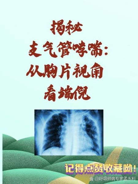 哮喘最好的自愈方法_哮喘能自己好吗-第1张图片-山城妙识 哮喘最好的自愈方法_哮喘能自己好吗-第1张图片-山城妙识