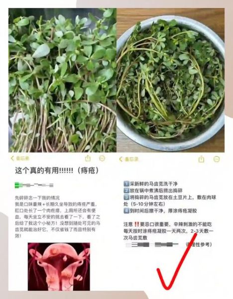 痔疮偏方真的有用吗_痔疮偏方有哪些-第2张图片-山城妙识