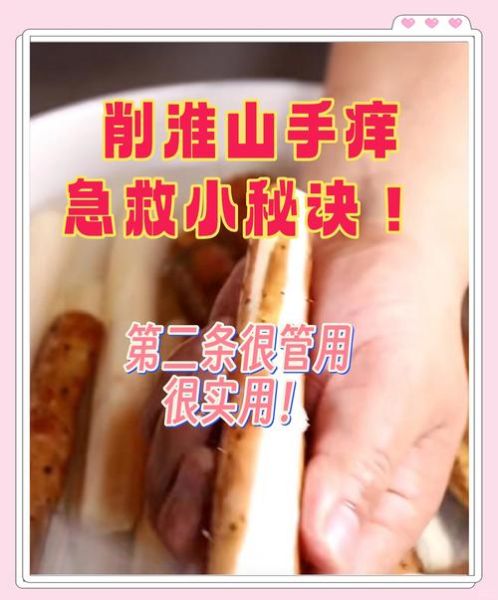 铁棍山药弄到手上很痒怎么办_止痒最快的小妙招-第1张图片-山城妙识 铁棍山药弄到手上很痒怎么办_止痒最快的小妙招-第1张图片-山城妙识