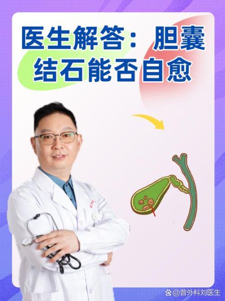 2厘米胆结石自己消失了_胆结石能自愈吗-第1张图片-山城妙识