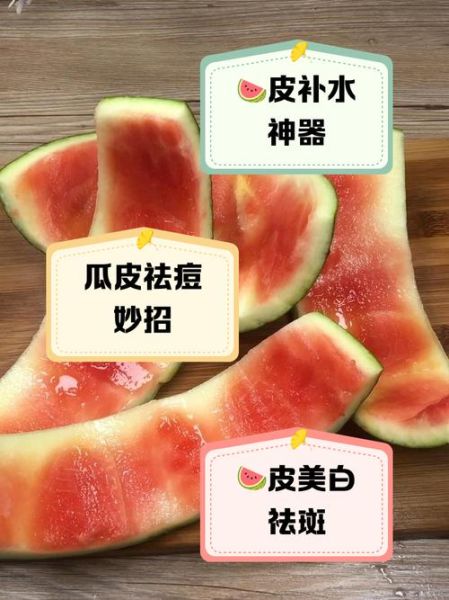 西瓜皮敷脸可以祛痘吗_西瓜皮祛痘的正确方法-第2张图片-山城妙识