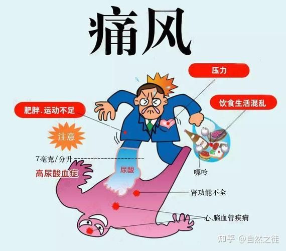 苏打水能缓解痛风吗_痛风喝苏打水有用吗-第2张图片-山城妙识