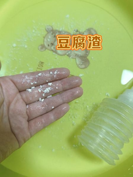 豆腐渣白带一周后自愈_豆腐渣白带能自己好吗-第3张图片-山城妙识