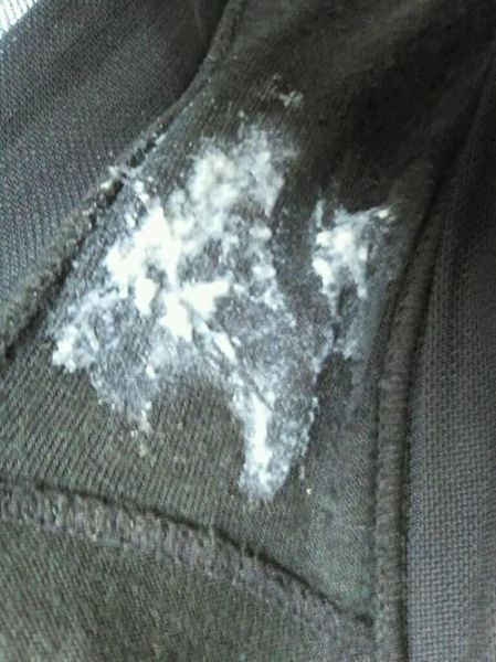 豆腐渣白带一周后自愈_豆腐渣白带能自己好吗-第2张图片-山城妙识