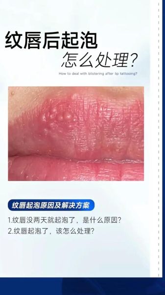 嘴唇起泡是癌的预兆_嘴唇起泡多久不愈合要警惕-第1张图片-山城妙识 嘴唇起泡是癌的预兆_嘴唇起泡多久不愈合要警惕-第1张图片-山城妙识
