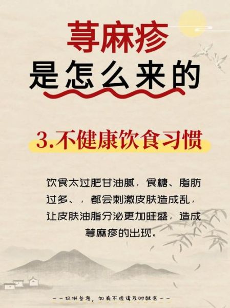 荨麻疹是毒素还是湿气_中医西医怎么看-第1张图片-山城妙识