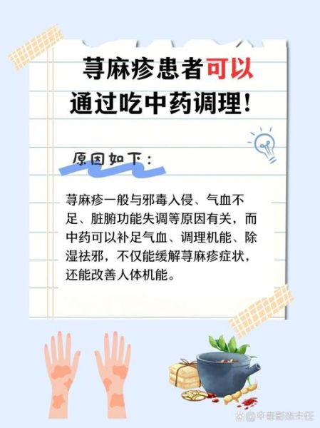 荨麻疹是毒素还是湿气_中医西医怎么看-第3张图片-山城妙识