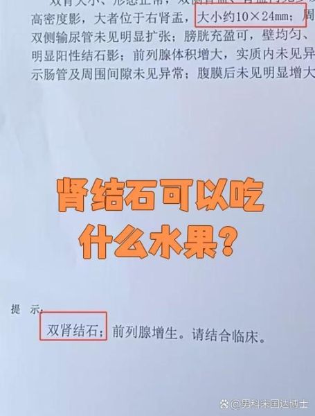 肾结石不能吃什么水果_肾结石禁忌水果有哪些-第2张图片-山城妙识 肾结石不能吃什么水果_肾结石禁忌水果有哪些-第2张图片-山城妙识