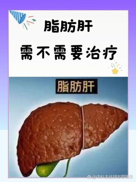 轻度脂肪肝怎么减_轻度脂肪肝多久能恢复-第3张图片-山城妙识