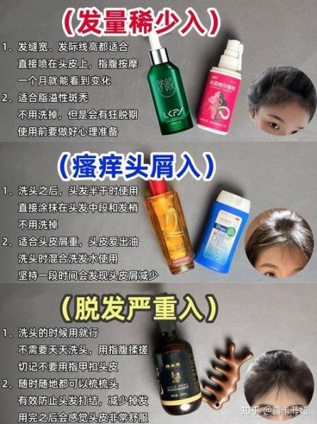 青少年脱发怎么办_青少年脱发严重怎么调理-第1张图片-山城妙识 青少年脱发怎么办_青少年脱发严重怎么调理-第1张图片-山城妙识