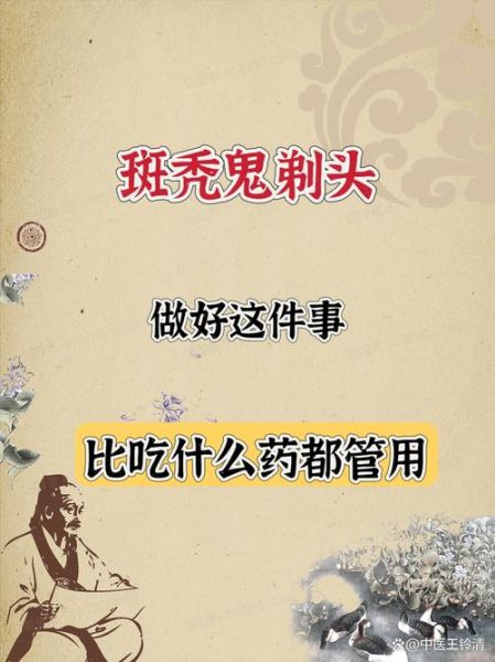 脱发严重怎么治疗才有效_脱发严重用什么药最好-第2张图片-山城妙识 脱发严重怎么治疗才有效_脱发严重用什么药最好-第2张图片-山城妙识