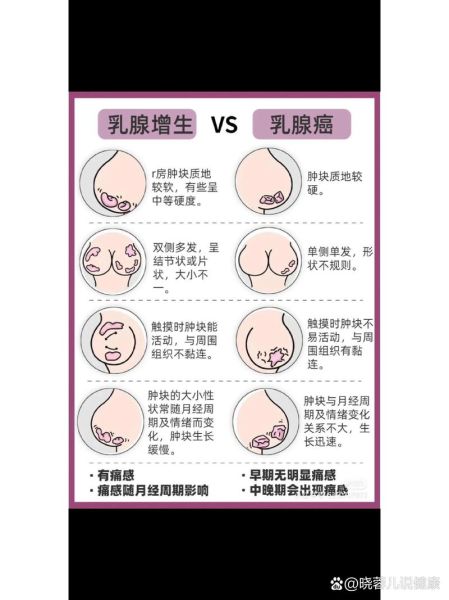 乳腺增生图片怎么看_乳腺增生症状有哪些-第2张图片-山城妙识