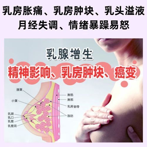 乳腺增生结节怎么消除_乳腺增生结节吃什么药-第2张图片-山城妙识 乳腺增生结节怎么消除_乳腺增生结节吃什么药-第2张图片-山城妙识