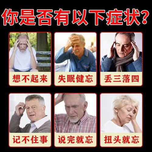 增强记忆力的药有哪些_副作用大吗-第3张图片-山城妙识