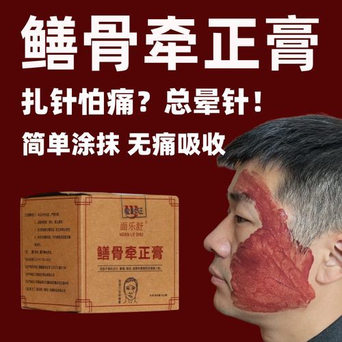 黄鳝血能治面瘫吗_黄鳝血治疗面瘫偏方真相-第2张图片-山城妙识