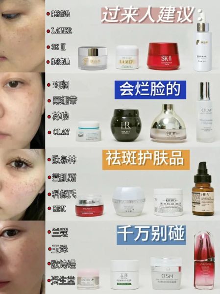 美白祛斑霜真的能祛斑吗_效果怎么样-第3张图片-山城妙识 美白祛斑霜真的能祛斑吗_效果怎么样-第3张图片-山城妙识