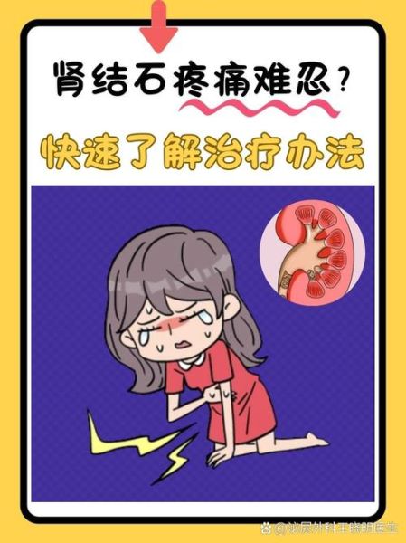 肾结石腰疼是好事_肾结石腰疼是不是好转了-第1张图片-山城妙识