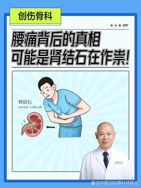 肾结石腰疼是好事_肾结石腰疼是不是好转了-第2张图片-山城妙识