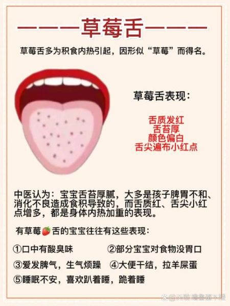 草莓舌头是什么病_草莓舌头怎么治疗-第3张图片-山城妙识