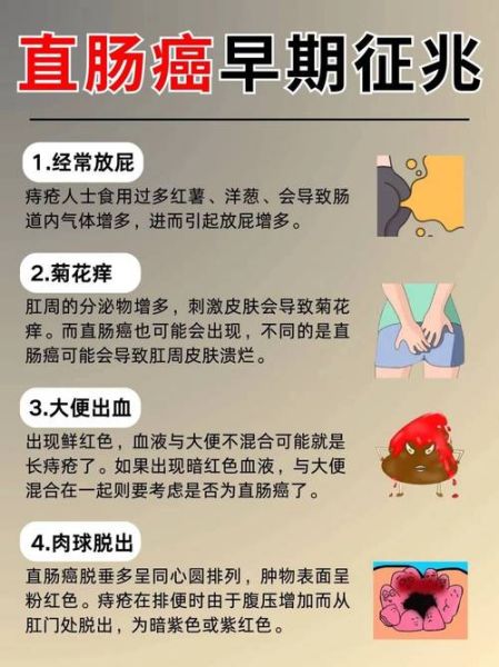 肠癌早期一天几次大便_肠癌早期排便次数变化-第3张图片-山城妙识 肠癌早期一天几次大便_肠癌早期排便次数变化-第3张图片-山城妙识