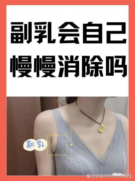 副乳怎么可以消除_副乳消除最有效的方法-第3张图片-山城妙识 副乳怎么可以消除_副乳消除最有效的方法-第3张图片-山城妙识