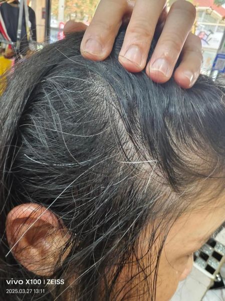 连喝三周白发变黑发_真的有用吗-第3张图片-山城妙识