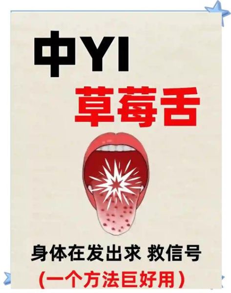 草莓舌的孩子一般是什么体质_如何调理-第3张图片-山城妙识