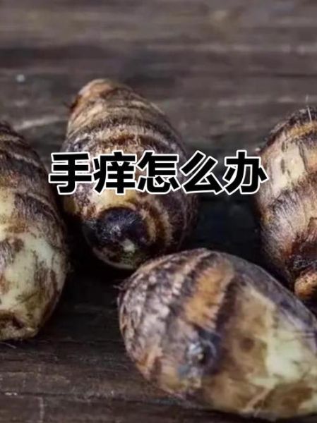 芋头手痒怎么办_最快止痒方法-第3张图片-山城妙识 芋头手痒怎么办_最快止痒方法-第3张图片-山城妙识