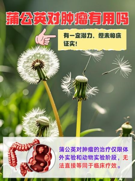 蒲公英能消除肿瘤吗_长期喝蒲公英水肿瘤消失可信吗-第1张图片-山城妙识